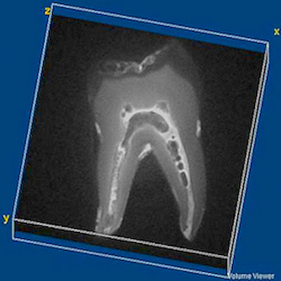 MRI and Medical Imaging: New dental MRI study yields best images yet