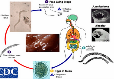 sikkahoder: Epidemiologi Cacing yang berkembang di Tanah menginfeksi ...