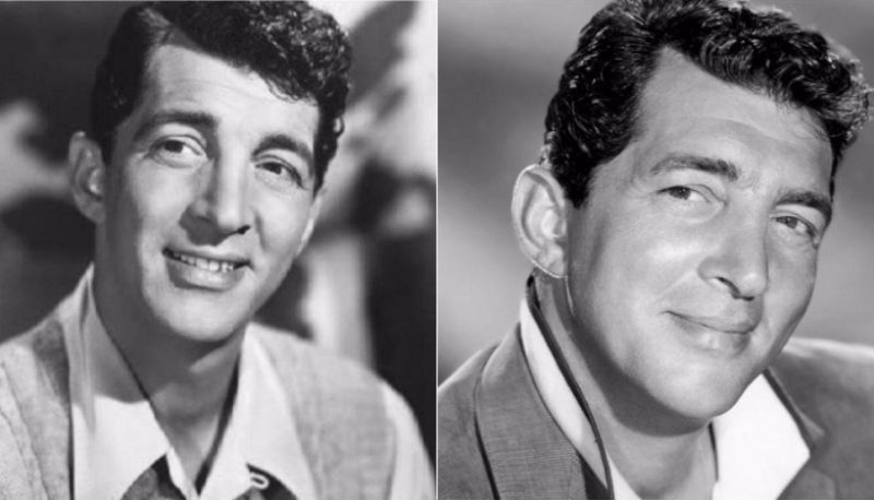 11 Classic Hollywood Stars Who Had Plastic Surgery ~ Vintage Everyday