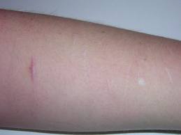 Erklärungen, Bilder, Hilferufe usw. übers ritzen!