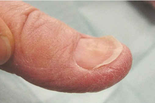 Nails and you ~ INFOSCOUT