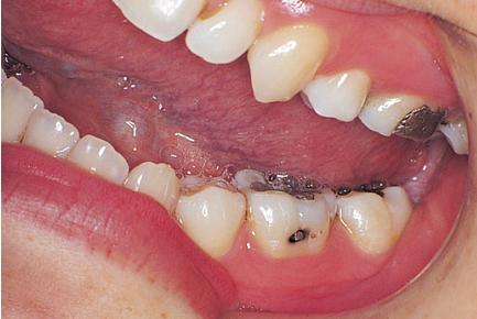 Dentistry lectures for MFDS/MJDF/NBDE/ORE: A Note on Clinical and ...