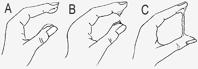Tentando Engravidar: Muco Cervical e fertilidade, como funciona?! - Da ...