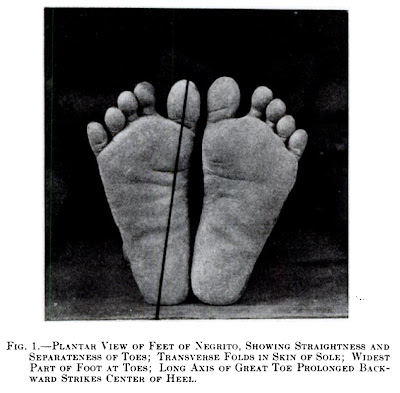 chooky fuzzbang: freaky toes