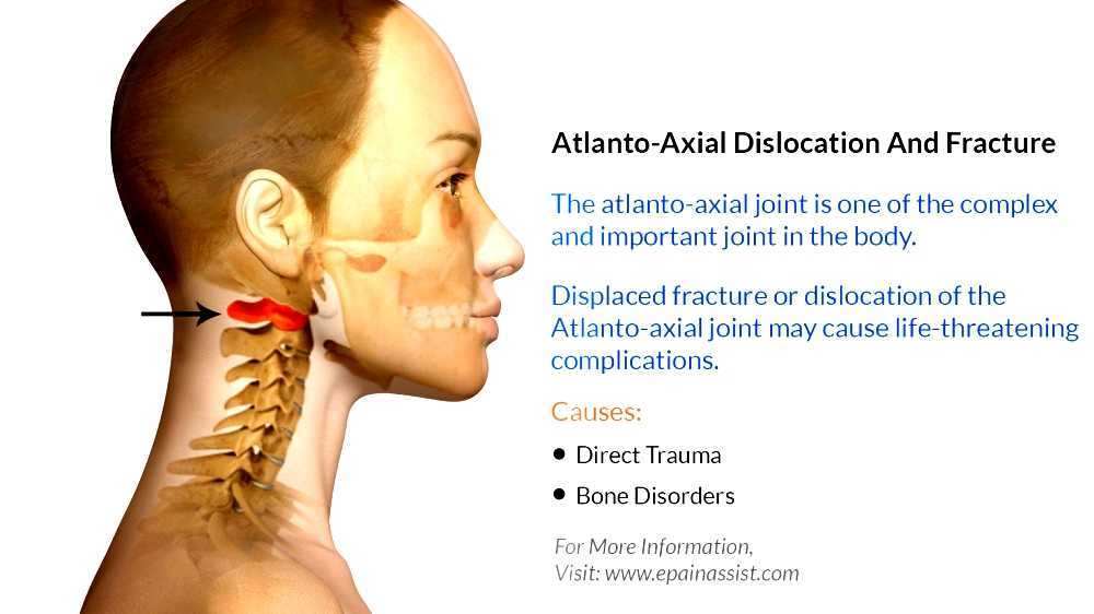 Atlanto-occipital joint