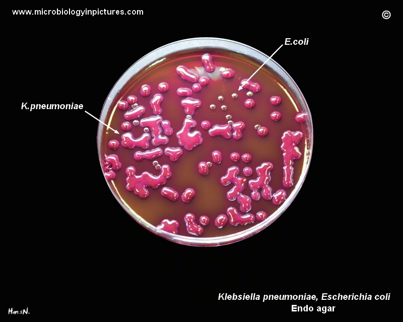 Endo Agar Microbiology Laboratory Turkey