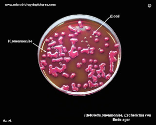 ENDO Agar - Microbiology Laboratory Turkey