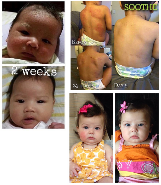 Skin Changes That Come with Motherhood - The Journey of Parenthood...