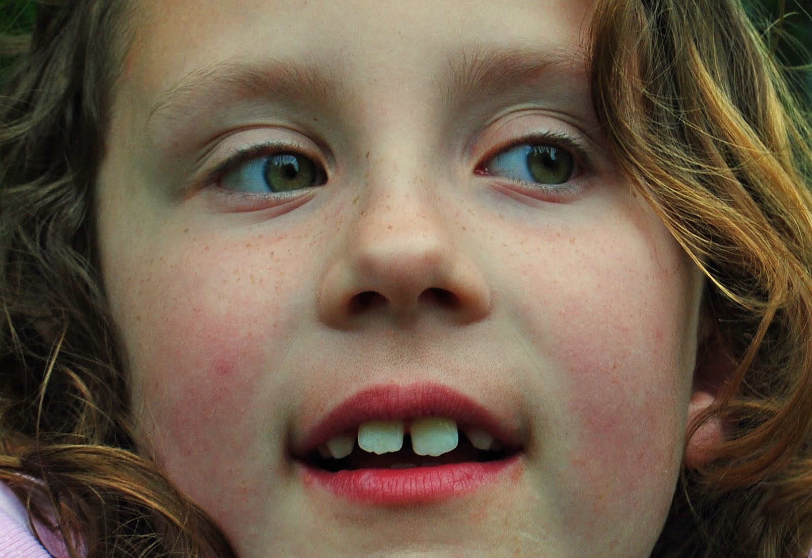 The Fragile X Files: Body Issues, at the Tender Age of 8