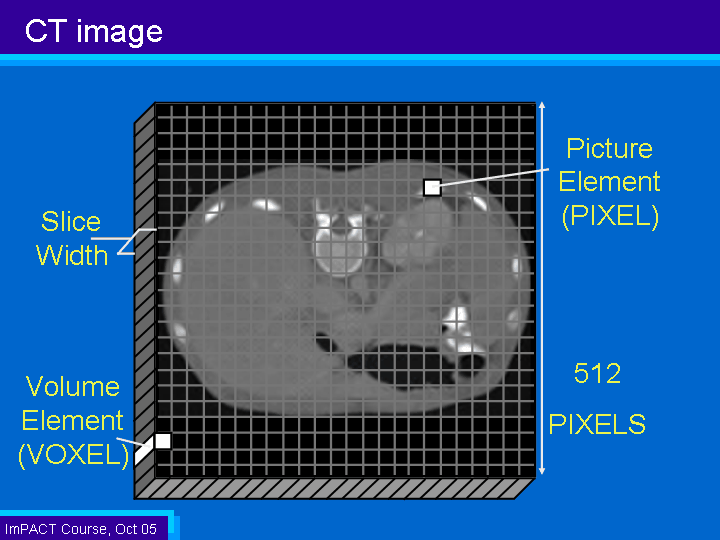 Basic principles of CT scanning ~ ct.scan.