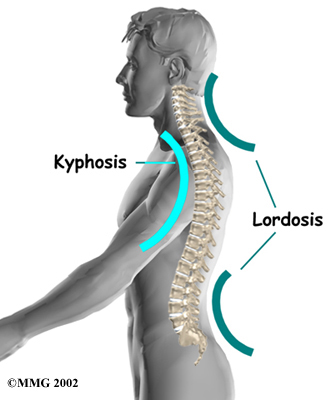 Free For Health: Lordosis Causes and Solutions