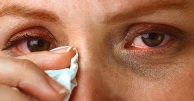 Obat Untuk Mengobati Mata Tua Secara Alami