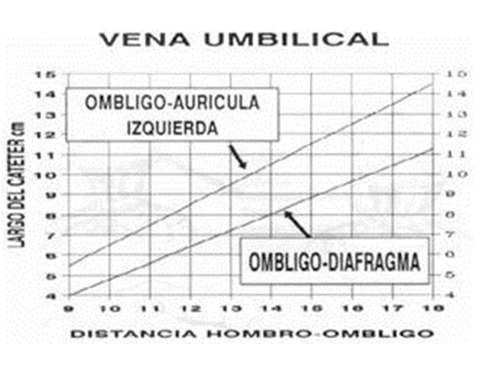 Casos Interesantes Pediatría ColocaciÓn De Cateter Umbilical