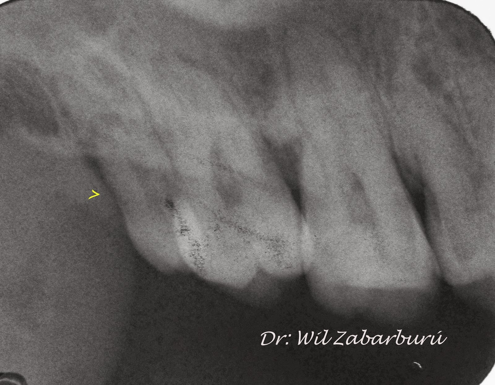 CLINICA DENTAL ASISTENCIAL: DISTOMOLAR