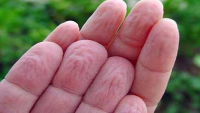 Mengapa Kulit Mengkerut Saat Menyentuh Air? | Blogger Unsil