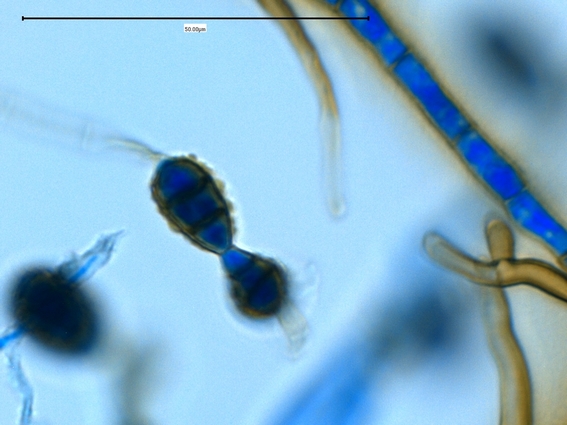 Fun With Microbiology (What's Buggin' You?): July 2015