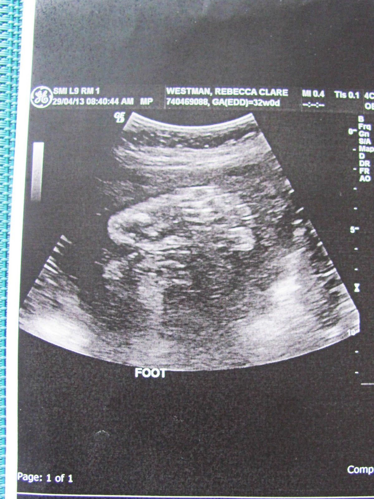 The Westman Family Blog: 8 MONTH ULTRASOUND