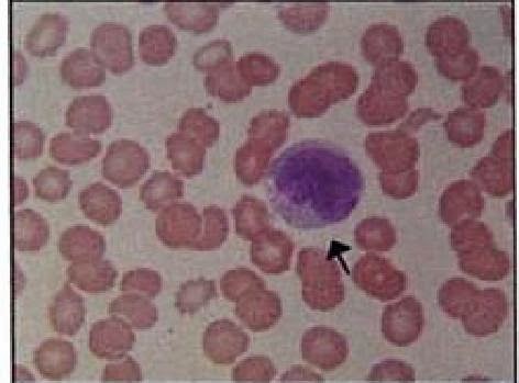 fichero hematologia: Promonocito