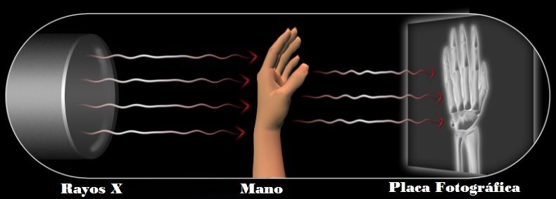 Radiología: Estructura Atómica