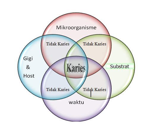 Semoga Bermanfaat ya: Empat faktor terjadinya karies gigi