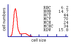 Speak Biology : MCV in blood report