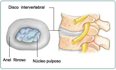 Educação Física - Para Todos: Biomecânica dos discos intervertebrais