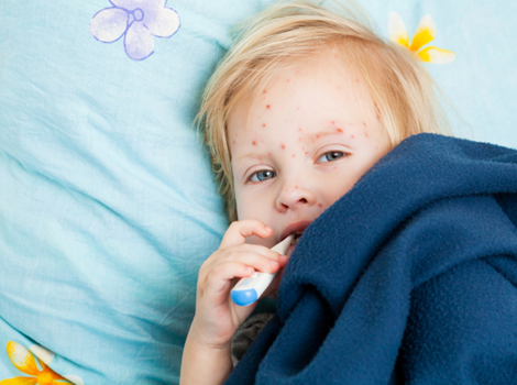 .NASF CARIRI.: CATAPORA: SAIBA COMO PREVENIR E TRATAR