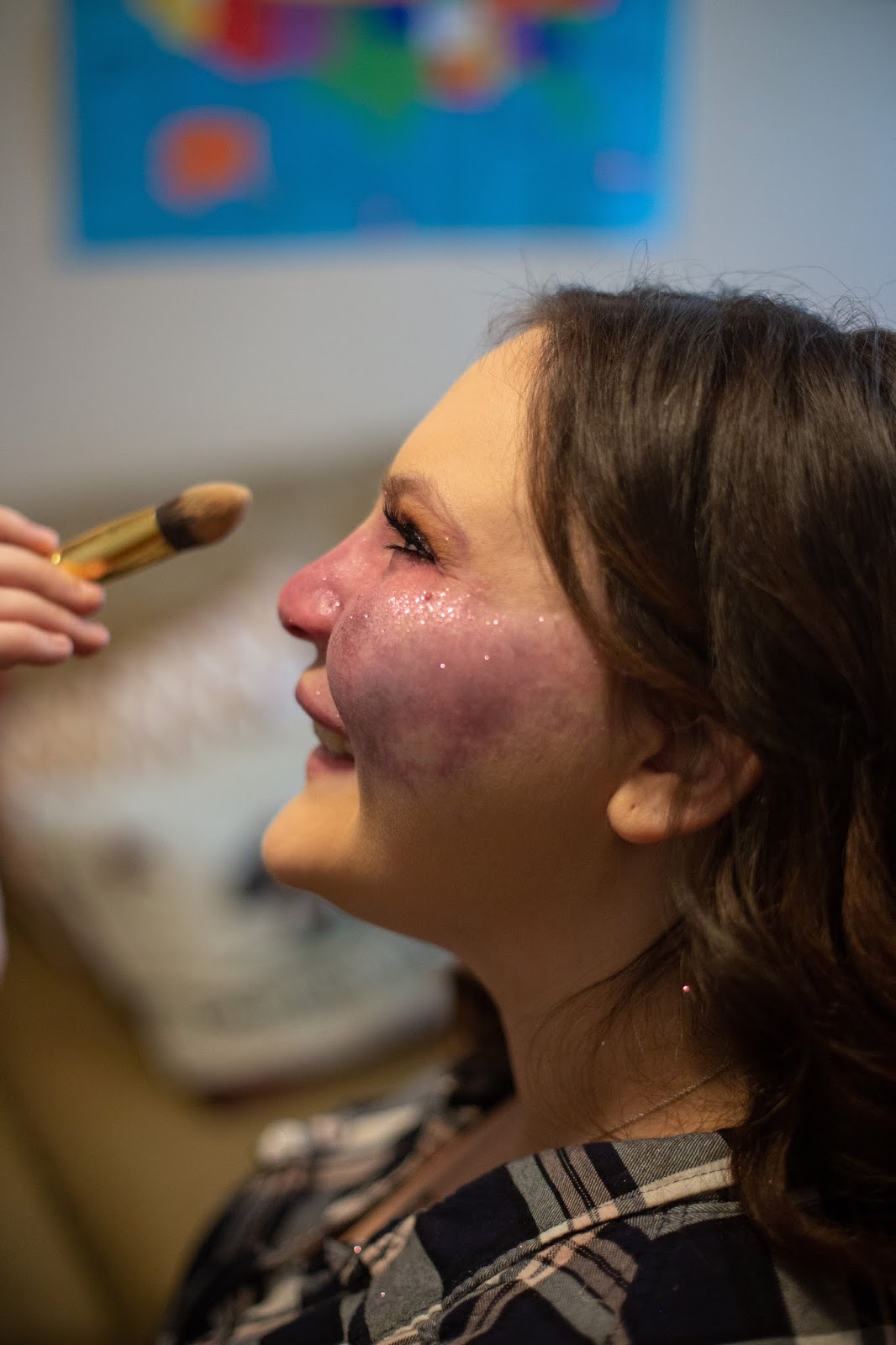 Crystal Hodges: How I Chose to Celebrate My Birthmark on My Wedding Day