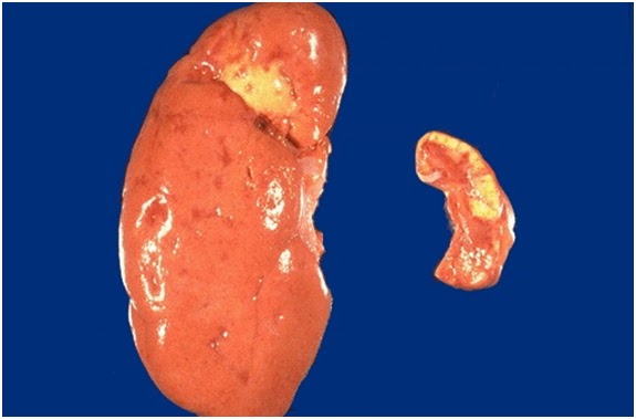 Department of Basic Medical Sciences, Faculty of Pharmcy, GU.PK ...