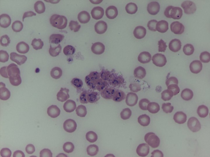 VETERINARY HEMATOLOGY DEXTERVET: Babesia Canis