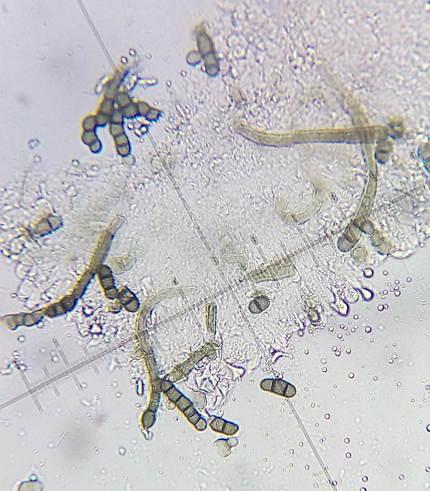 Myco Magic: Dematiaceous hyphomycetes