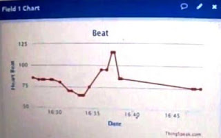 Heart Beat Monitoring over Internet using Arduino and ThingSpeak ...