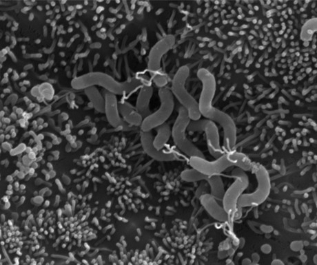 BtB#6: H pylori Urease