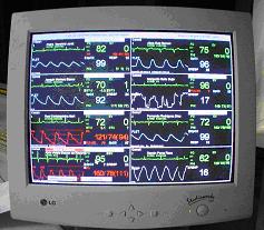 Diary of a future nurse: ICU: Monitorización NO INVASIVA