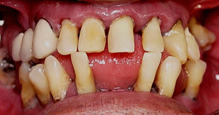 Mundo Odontológico: Actualización en elementos de diagnostico y ...