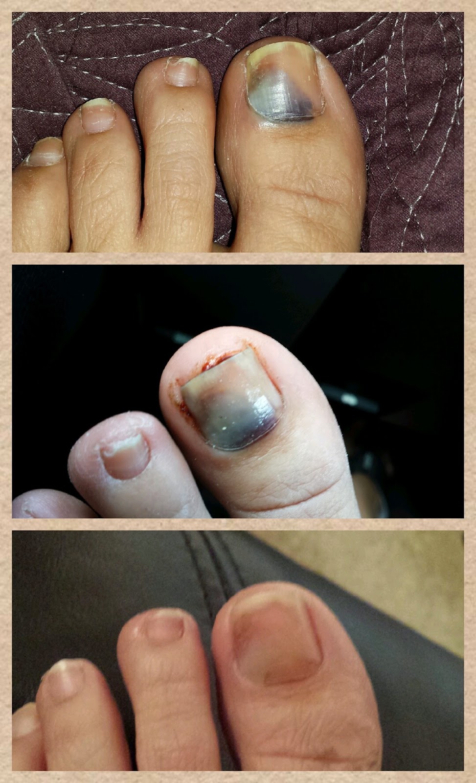 PAMELA FIGHTS IN PINK!: Chemo #6 & Taxol - Dehydration got me again!