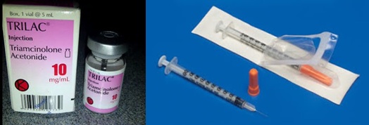 Keloid (Pengalaman Suntik Keloid di Rumah Sakit) (7)