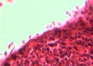 Splendor Koi & Pond: Costia