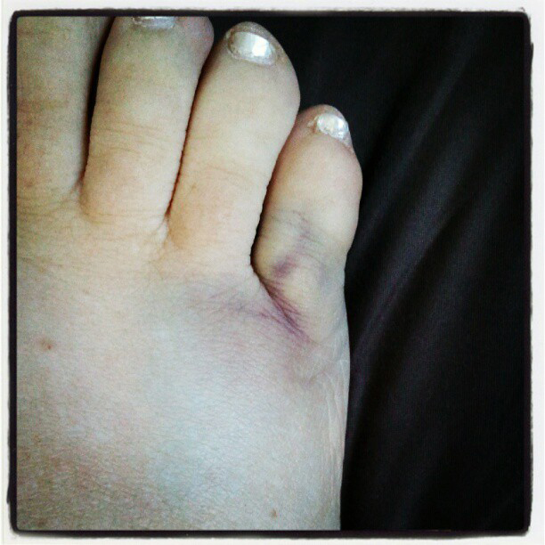 6 La La's: THE SAD, SAD TALE OF A PINKIE TOE