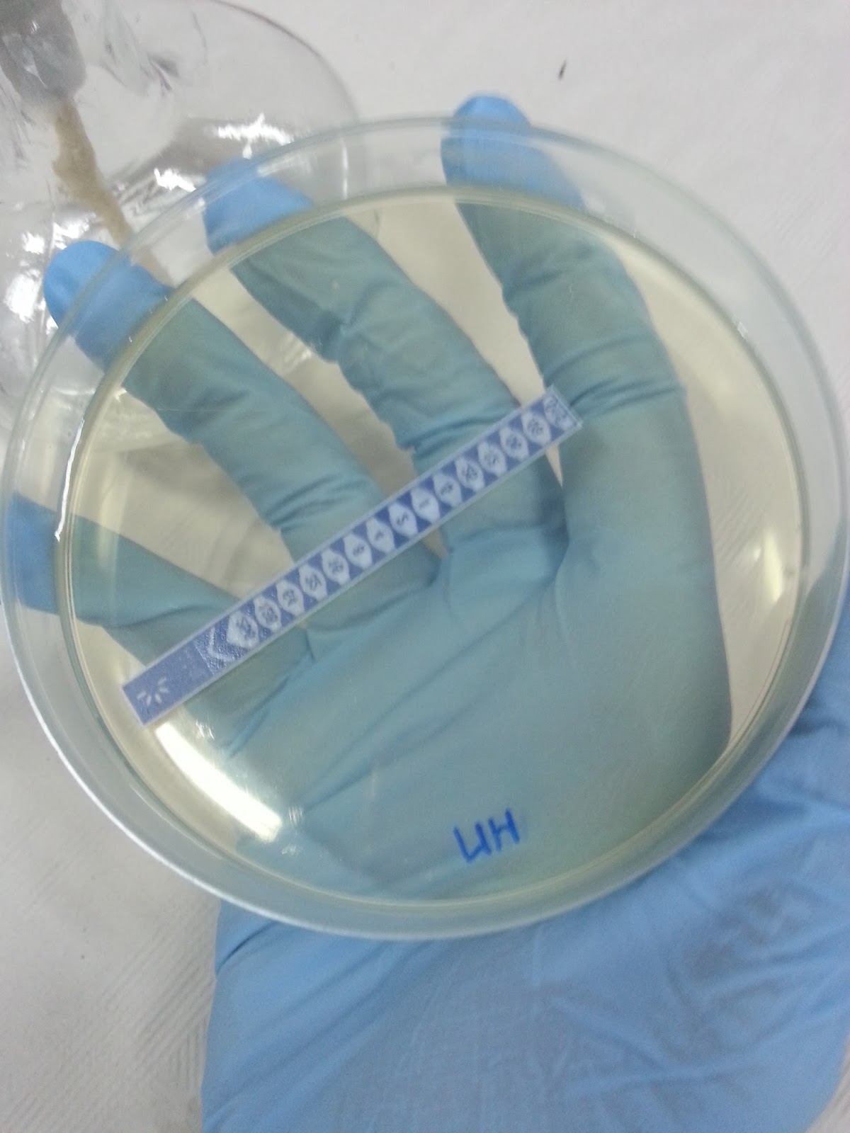 MICROBIOLOGÍA: Epsilon test