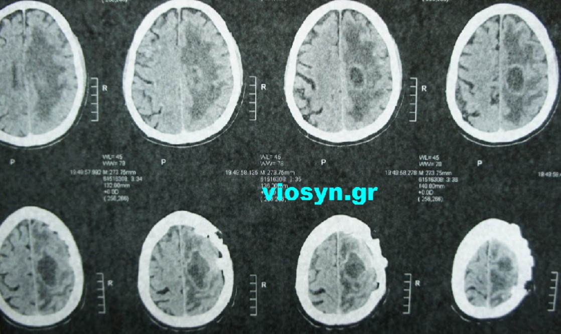 ΠΡΩΤΟΠΟΡΙΑΚΗ ΘΕΡΑΠΕΙΑ ΣΟΒΑΡΟΥ ΠΡΟΒΛΗΜΑΤΟΣ ΥΓΕΙΑΣ (ΠΑΡΟΥΣΙΑΣΗ ...