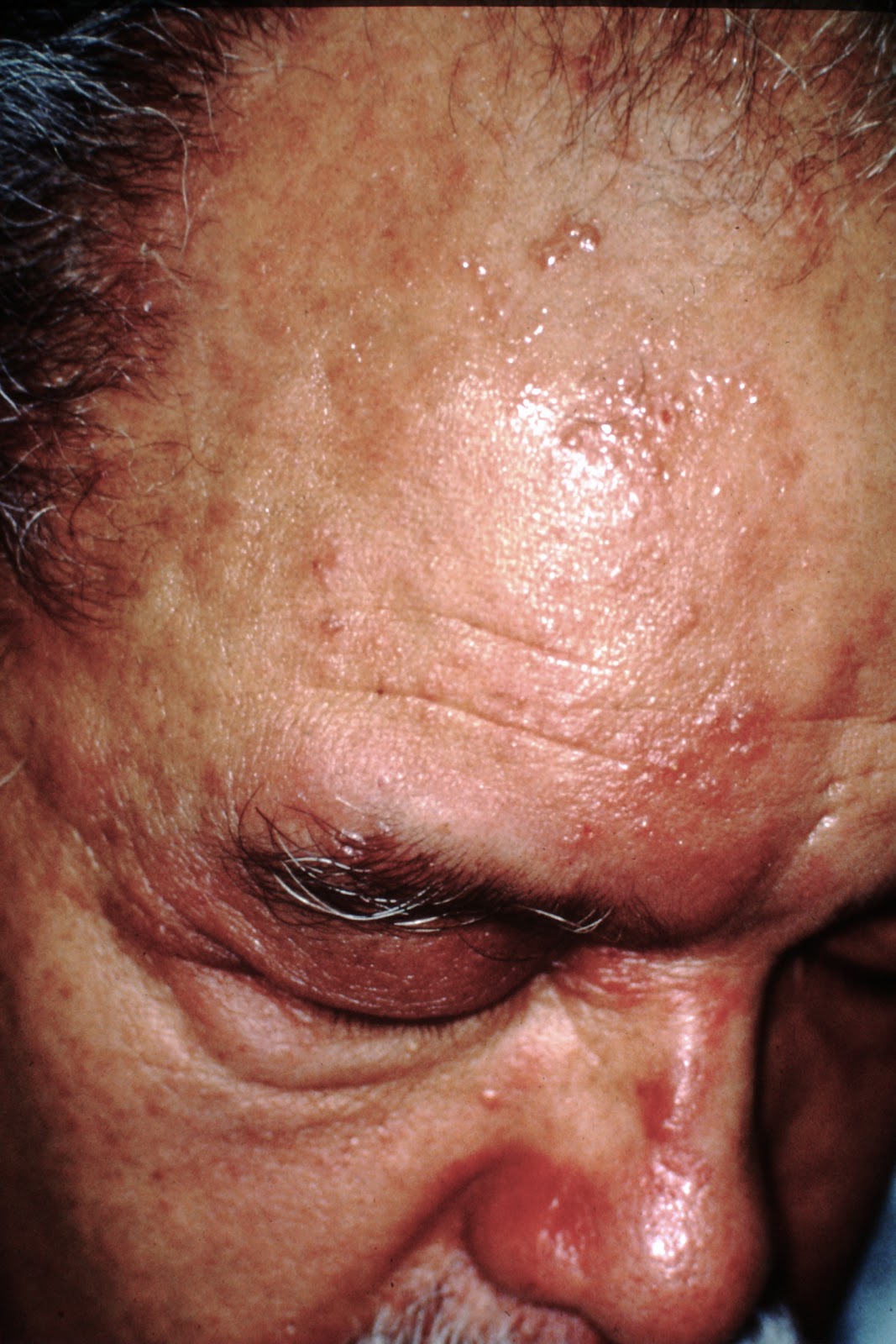 Derm Challenge: April 2012