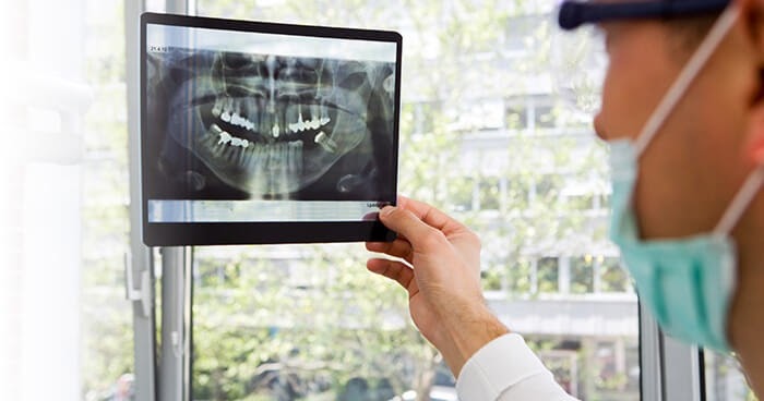 Woburn Dental Associates: What is a Cavity and What Causes Tooth Decay?