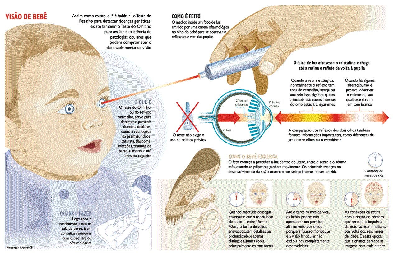 Dr. Deo de Freitas: Teste do Olhinho ou do Reflexo Vermelho