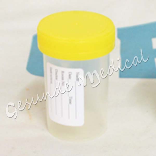 Jual Urine Container Pot Steril | Botol Urine Air Kecing | Wadah Pot ...