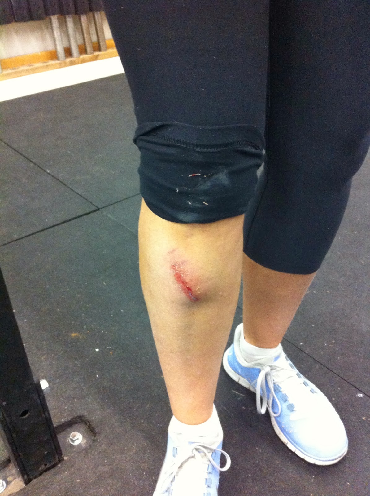 Box Jumps Injury
