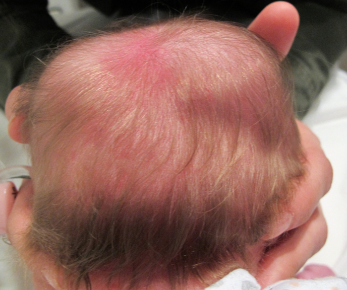 RED LATINOAMERICANA DE PEDIATRÍA Y NEONATOLOGÍA: [Caso Clínico ...