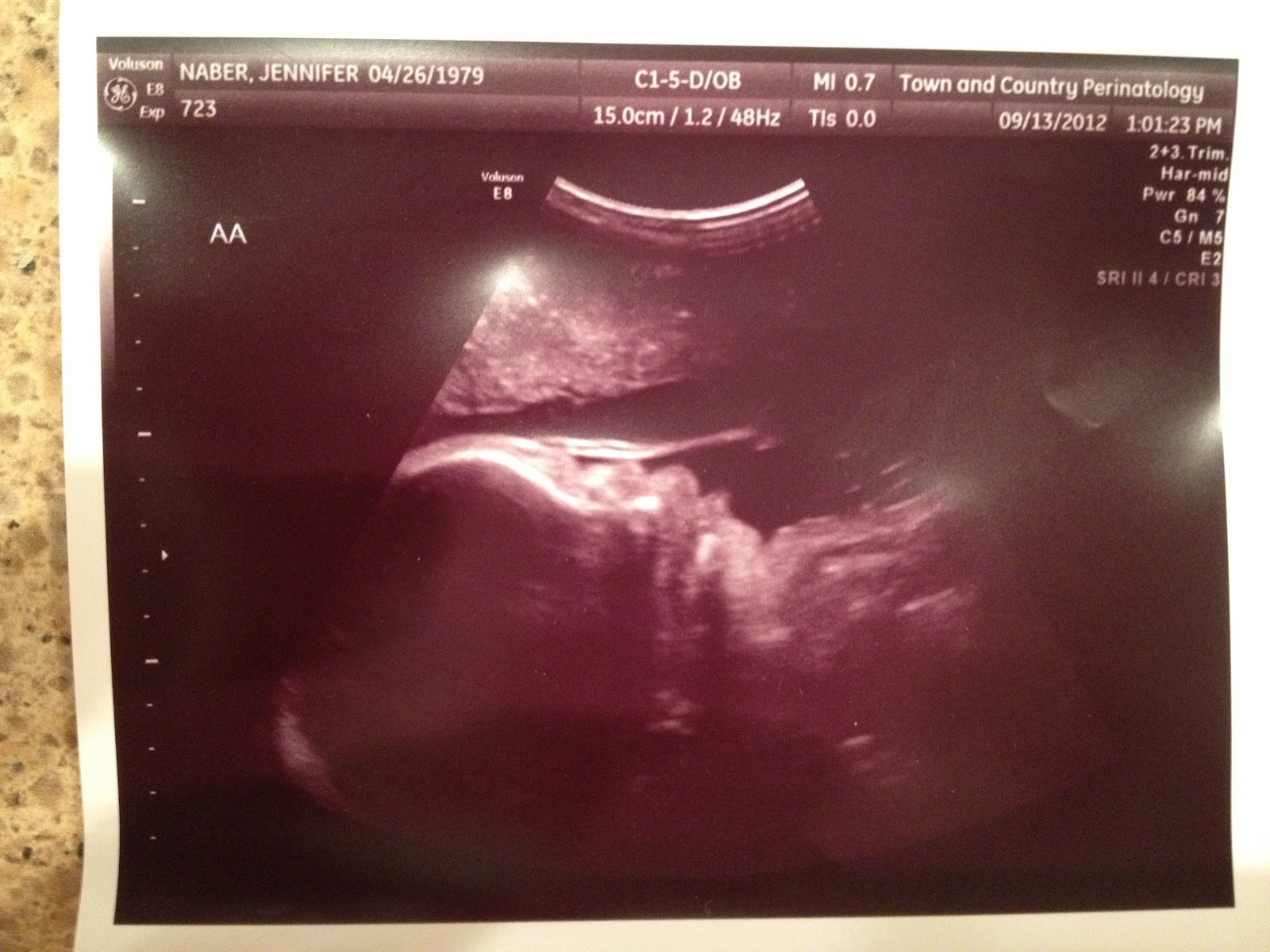 Our journey to be parents: 34 weeks pregnant