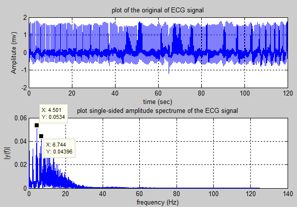 Biomedical Signal And Image Processing Projects Using Matlab And Labview Tools Matlab Code To 2373