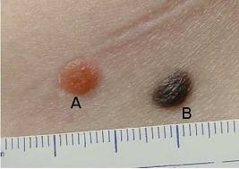 "Marianny Guzman" Semiología Quirurgica: Examen de Cabeza y Cuello I